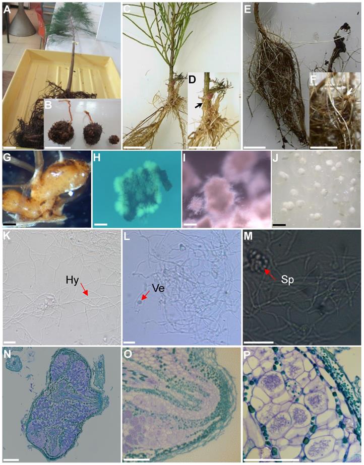 Draft Genome Sequence of the Symbiotic Frankia sp. strain B2 isolated ...